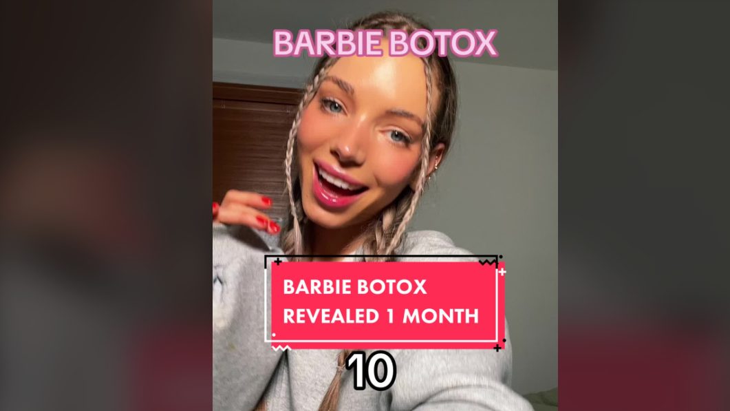 Che cos'è il Barbie botox di cui si parla tanto su TikTok